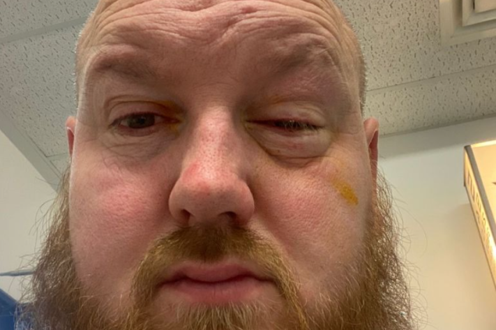 Royaume-Uni : Paul Laskey, un Britannique de 43 ans qui avait reçu de l ...